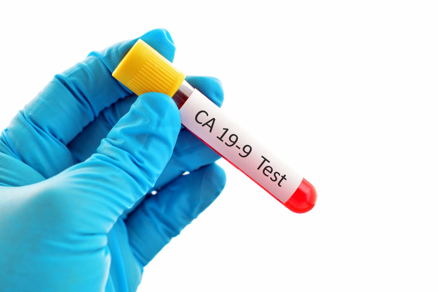 Understanding the Symptoms and Treatments to Pancreatic Cancer | Omega ...