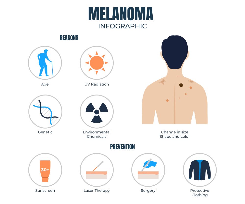 The Ultimate Guide to Skin Cancer: Protect Your Skin