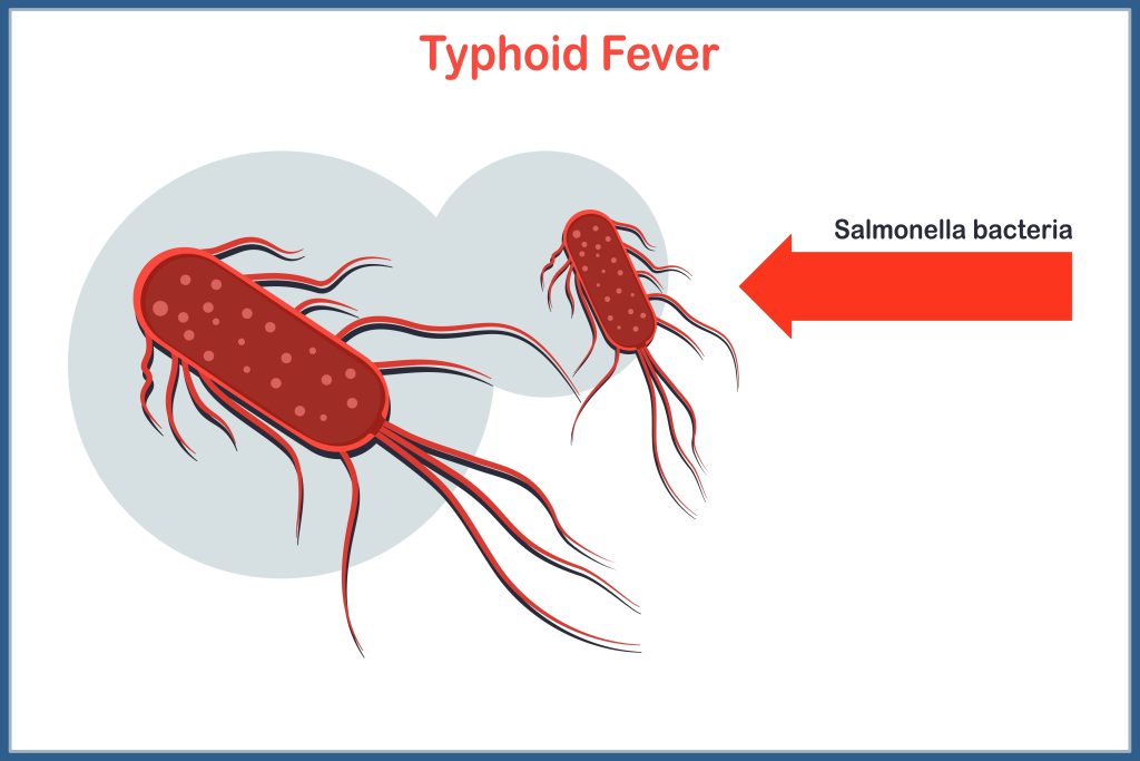 Understanding Typhoid: Causes, Symptoms, Prevention, and Treatment