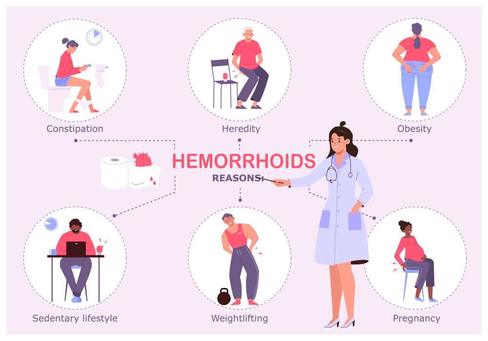 Haemorrhoids Explained: What You Need to Know for Better Health Management