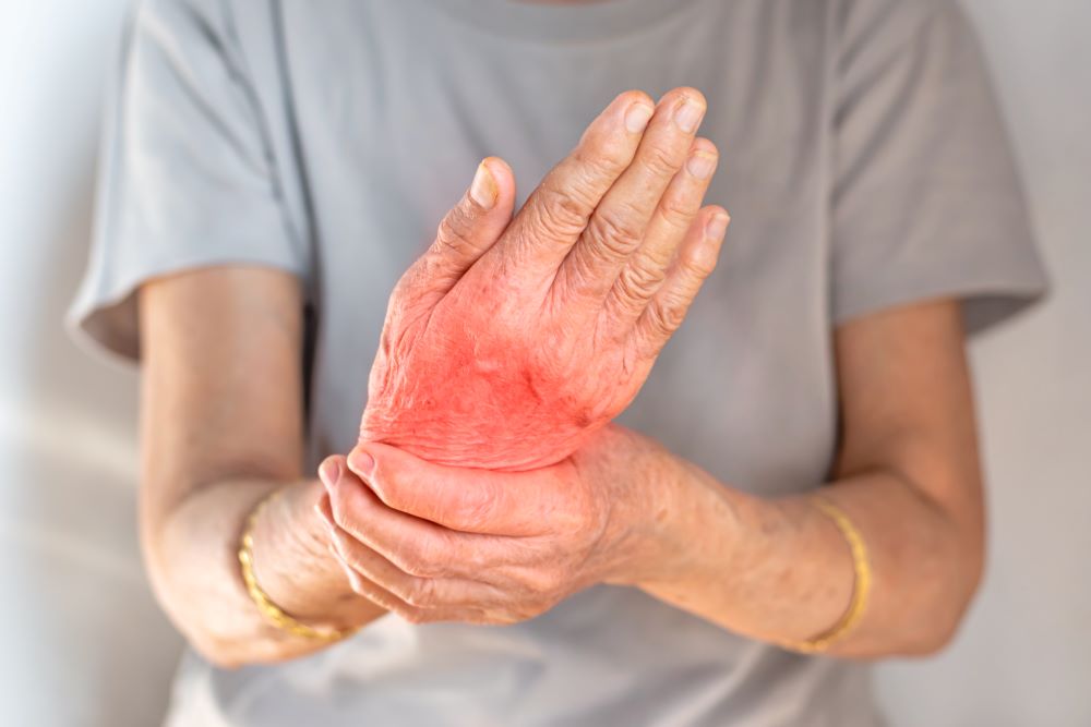 The Comprehensive Guide to Rheumatoid Arthritis (RA)