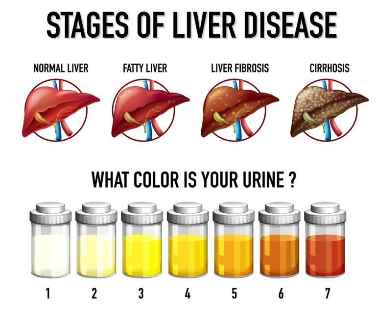 Liver Function Tests Explained: Purpose, Types & Key Insights