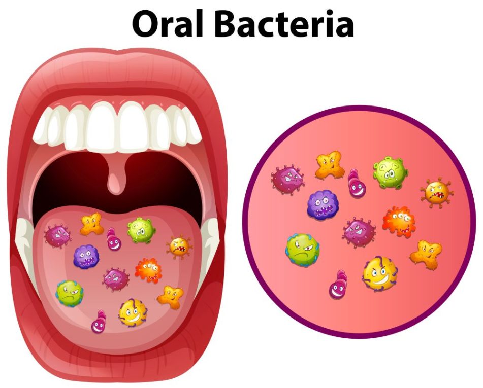 The Role of Oral Bacteria in the Development of Dental Caries