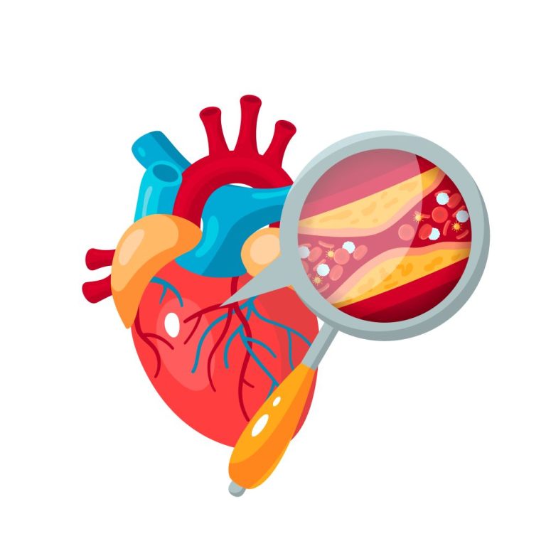 Triglycerides & Heart Health: Best Ways to Keep Them in Check