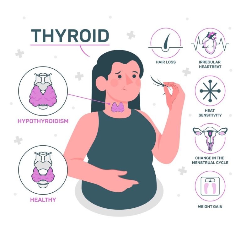 Understanding Hypothyroidism: Symptoms, Causes, and Prevention Tips