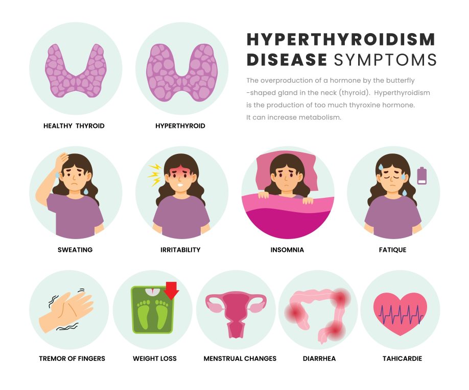 Hyperthyroidism: Symptoms, Causes, and Treatment