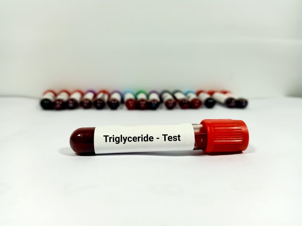 Triglycerides & Heart Health: Best Ways to Keep Them in Check