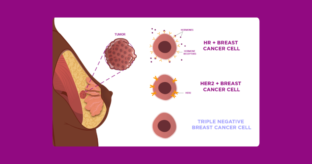 What is Triple Negative Breast Cancer? Symptoms, Risks, and Treatment ...