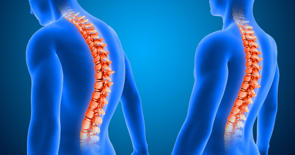 Understanding Your Spine: A Simple Guide to Spinal Anatomy - Blogs ...