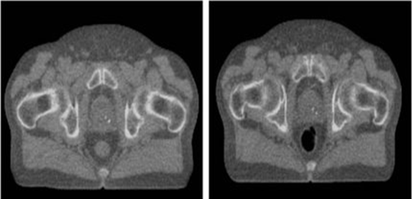 Ethos Linac (AI-Powered) | Radiation Therapy | Omega Hospitals
