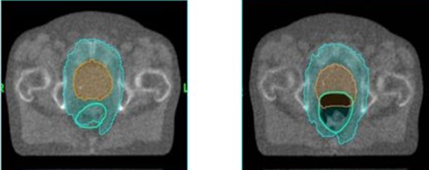 ETHOS LINAC (AI-POWERED) - Omega Hospitals