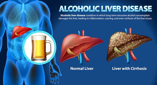 Understanding the Symptoms and Treatments to Liver Cancer | Omega Hospitals
