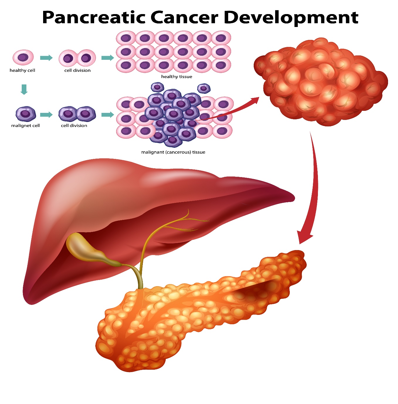Understanding the Symptoms and Treatments to Pancreatic Cancer | Omega ...