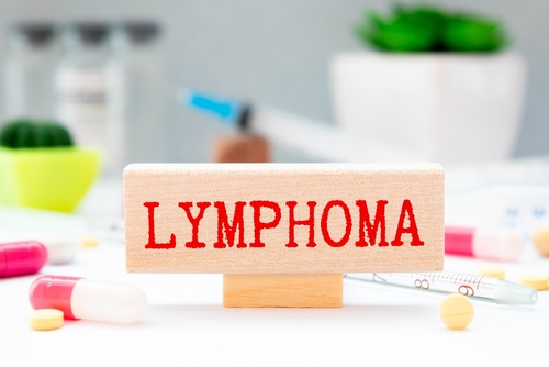Lymphoma - Blogs | Latest Articles | Omega Hospitals